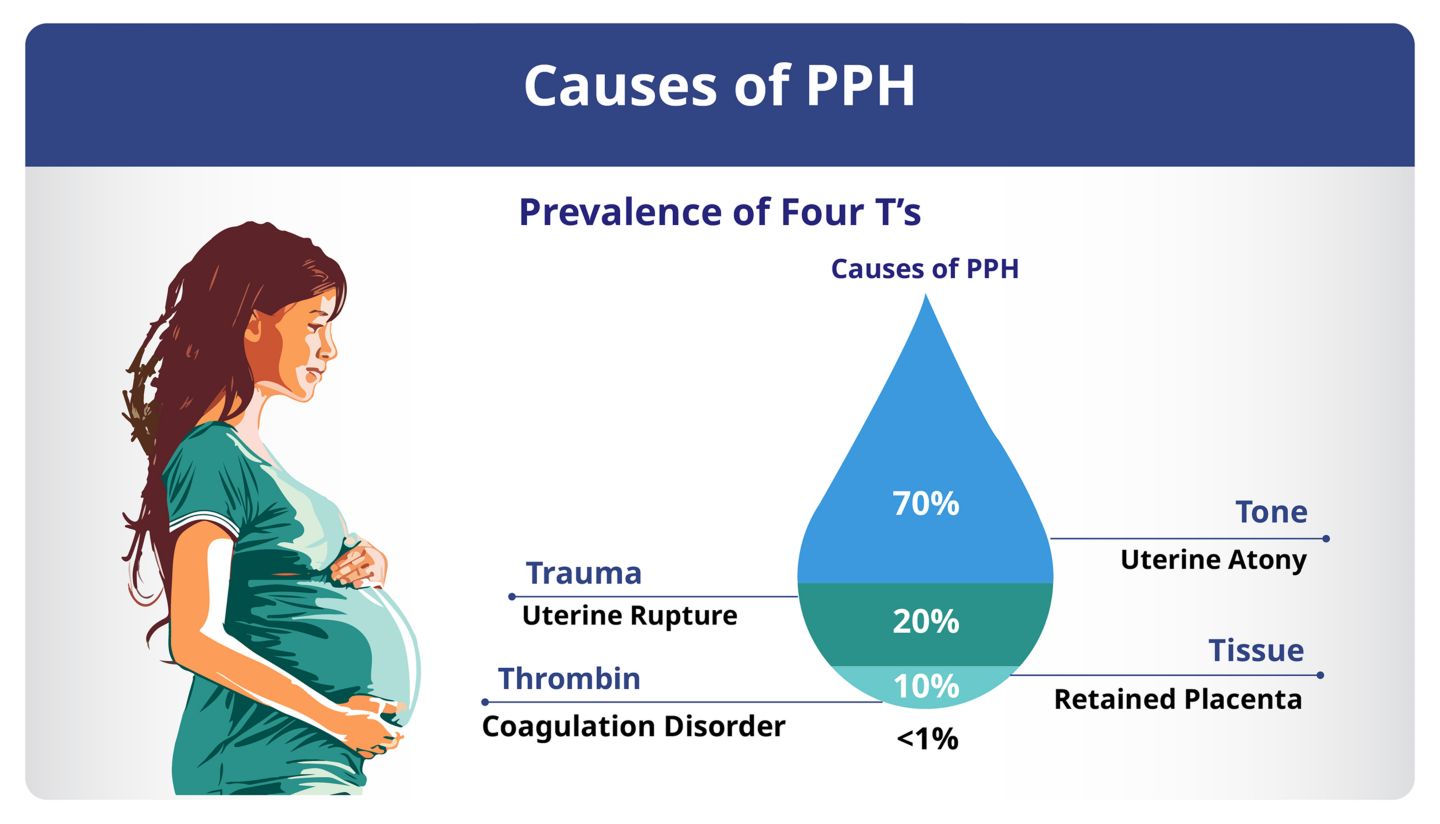 Prevention and Management of PPH