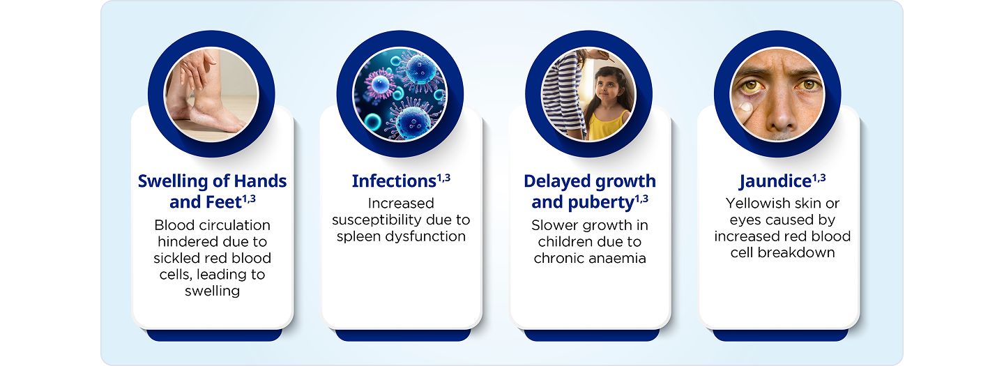 SCD DIAGNOSIS AND SCREENING Detect early | Manage better